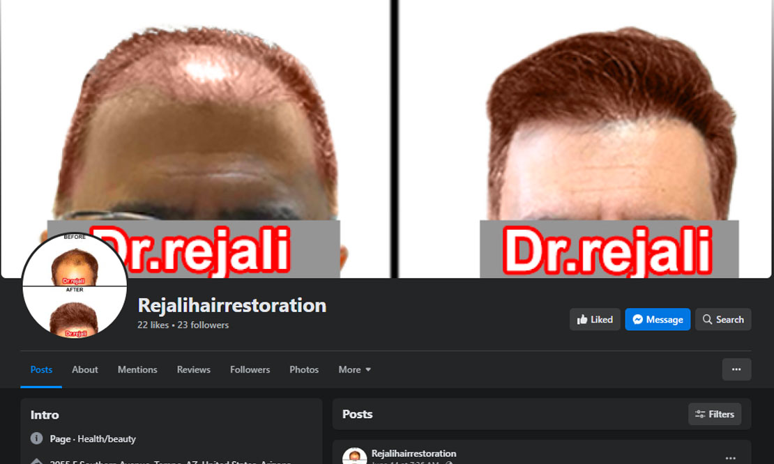 Rejali Medical - Hair Restoration & MedSpa - FUE Hair Transplant