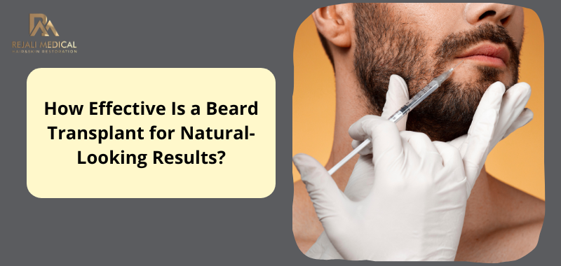 How Effective Is a Beard Transplant? Natural-Looking Results Explained